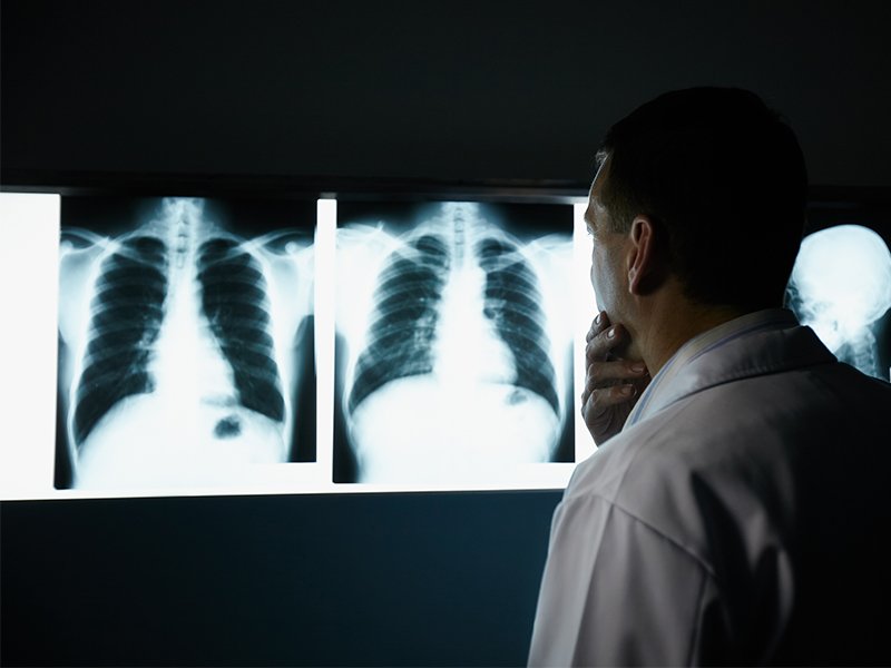 doctor-viewing-xray-reports – Banking School